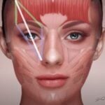 Best Botox eyebrow lift injection patterns | Dr Tim Pearce