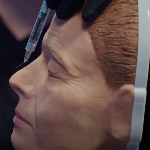 How to bend your needle for dermal fillers | Dr Tim Pearce