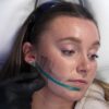Safety First Masseter Injection Technique | Dr Tim Pearce