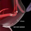 Where's the Artery? Mastering 3D Lip Anatomy | Dr Tim Pearce
